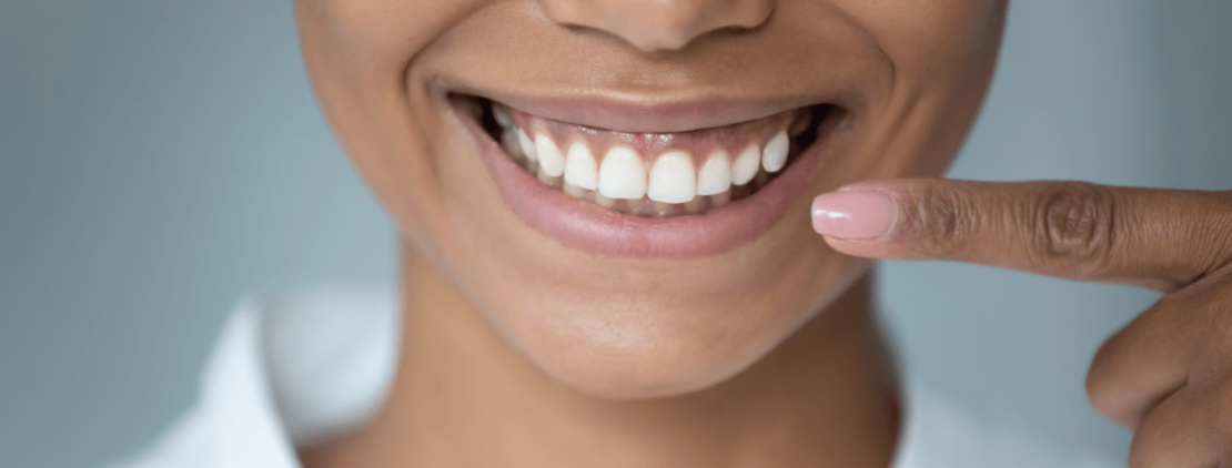 3 Tricks to Get Straight Teeth - Ascent Family Dental